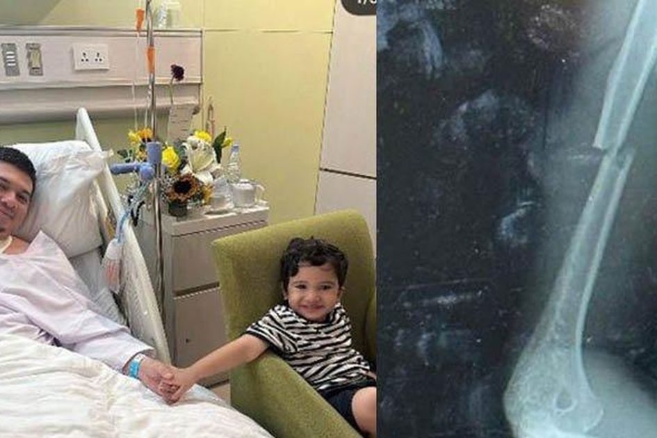 Hasil Rontgen Tangan Irwansyah Terungkap, Kondisi Suami Zaskia Sungkar ...