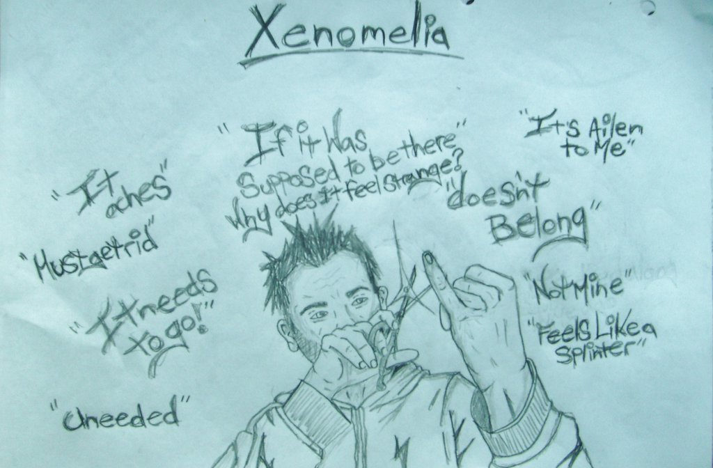 Xenomelia, Penyakit Mental yang Memicu Penderitanya Ingin Mengamputasi ...