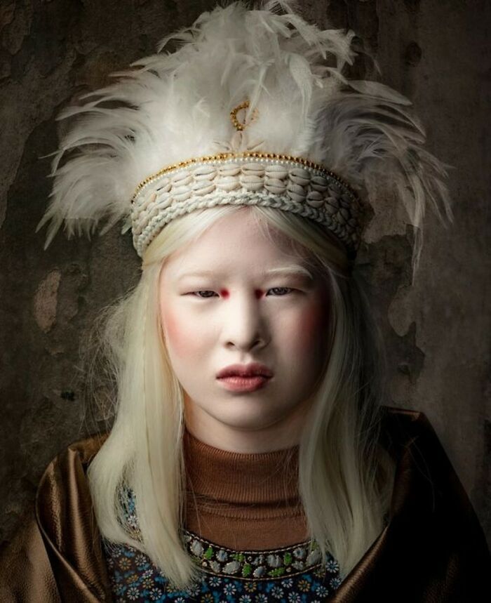 7 Potret Model Albino Xue Li yang Dibuang Orang Tuanya Sendiri - Semua ...