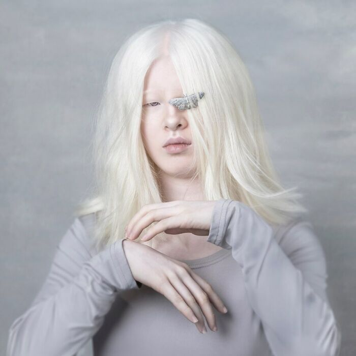 7 Potret Model Albino Xue Li yang Dibuang Orang Tuanya Sendiri - Semua ...