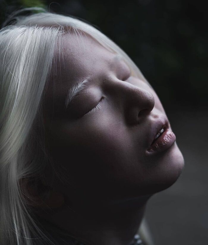 7 Potret Model Albino Xue Li yang Dibuang Orang Tuanya Sendiri - Semua ...
