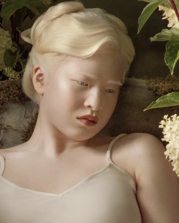 7 Potret Model Albino Xue Li yang Dibuang Orang Tuanya Sendiri - Semua ...
