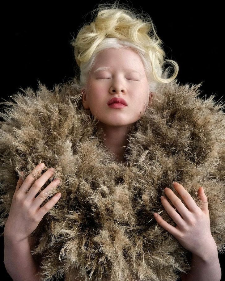 Xueli, Gadis Albino yang Sempat Dibuang dan Kini Jadi Model Vogue ...