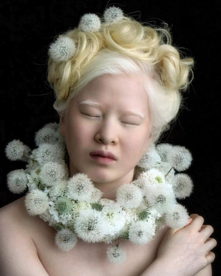 Xueli, Gadis Albino yang Sempat Dibuang dan Kini Jadi Model Vogue ...