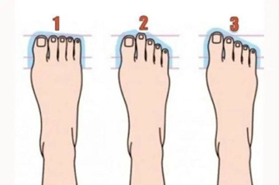 3 Bentuk Kaki yang Disebut Bawa Hoki dan Keberuntungan, Coba Cek ...