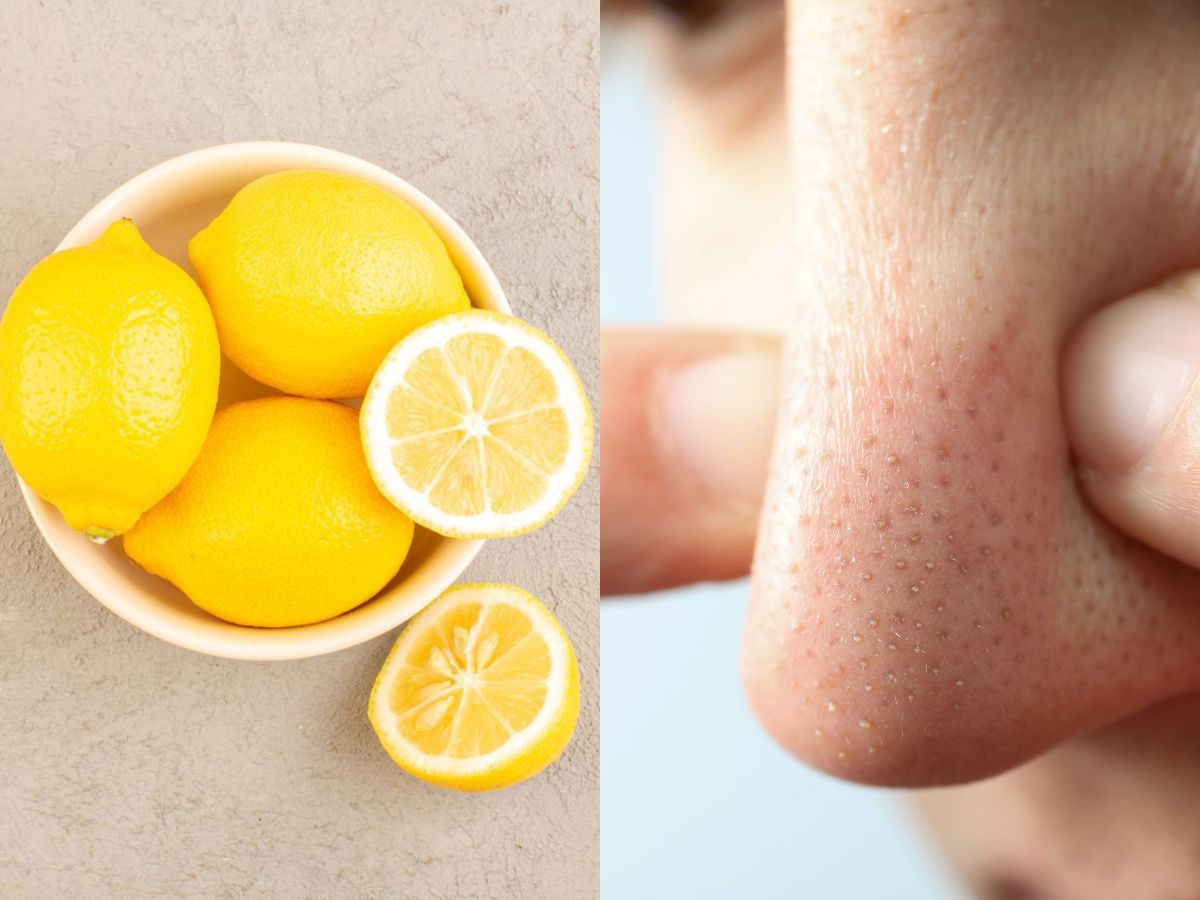 Kasih Tahu Suami, Cara Membuat Masker Komedo dari Lemon, Cespleng ...