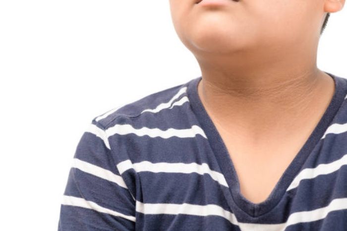 Ketahui Gejala dan Penyebab Leher Hitam, Akibat Dermatitis atau Diabetes?