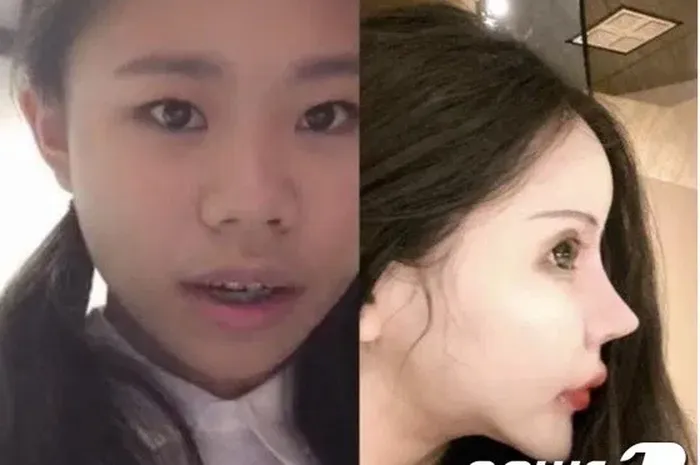 ‘Saya Tidak Akan Pernah Puas dengan Penampilan Saya’ Kisah Gadis 16 ... ‘Saya Tidak Akan Pernah Puas dengan Penampilan Saya’ Kisah Gadis 16 ...