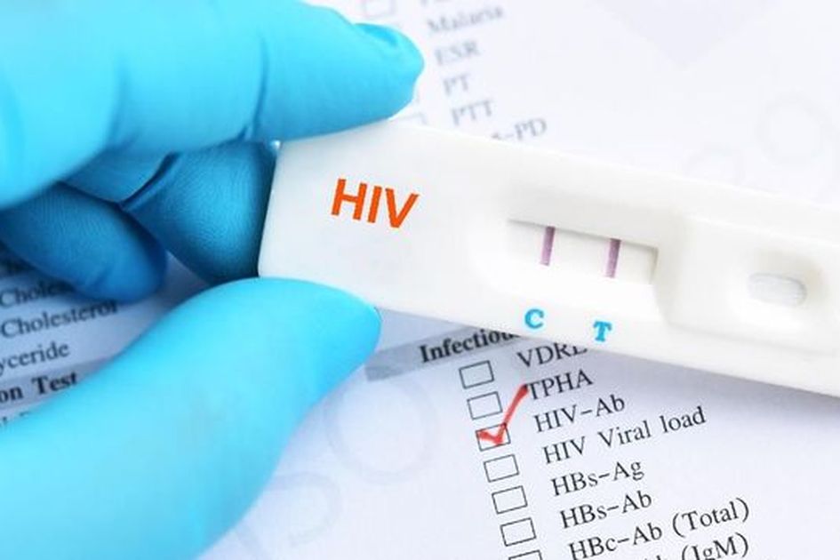 Marak Kasus HIV AIDS Mahasiswa, Dosen UM Surabaya: Hindari Aplikasi ...