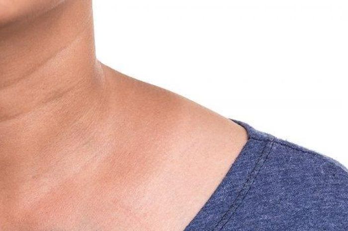 Kenapa Daki Hitam di Leher Susah Hilang? Ini Penyebabnya Wajib Tahu ...