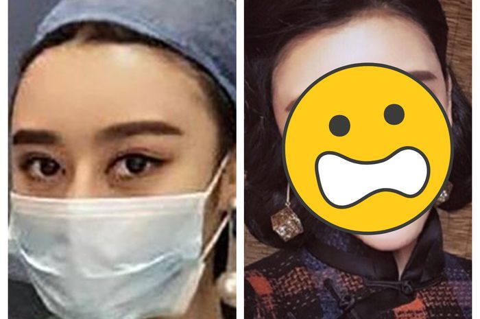 8 tahun Operasi Plastik, Perempuan Ini Punya Wajah Sama Persis dengan ...