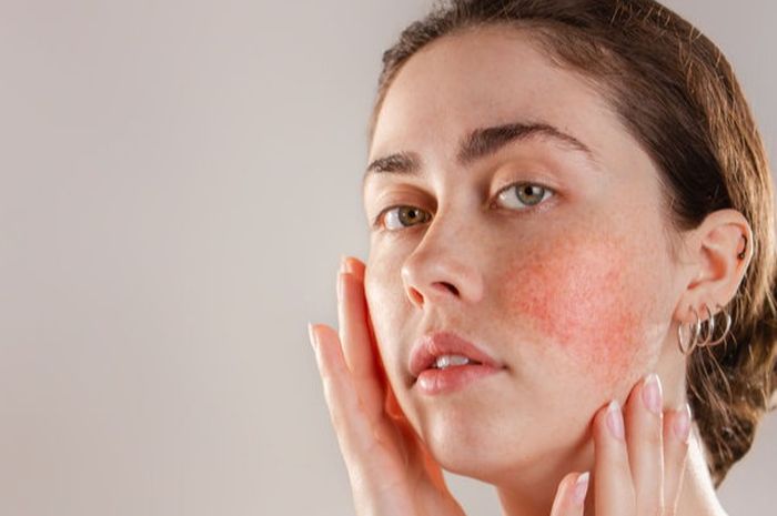 3 Cara Menghilangkan Iritasi dan Kemerahan Kulit Wajah dengan Skincare ...