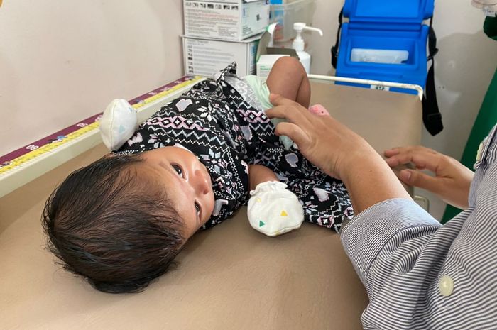 Gejala Ruam Popok yang Perlu Diwaspadai oleh Orangtua - Nakita