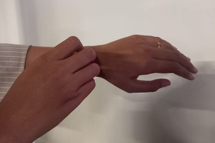 Penyakit Kulit Ringworm Bisa Ditularkan dari Sesama Manusia dan Hewan ...