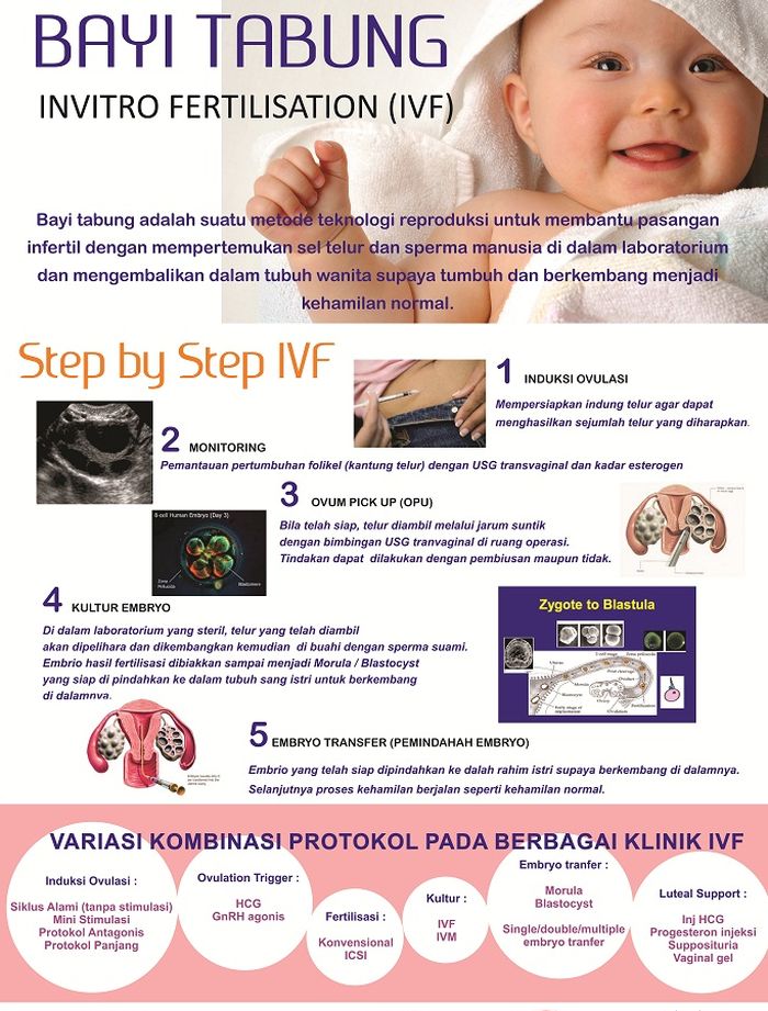 Mengenal Program Bayi Tabung, Langkah Demi Langkah - Semua Halaman - Nakita