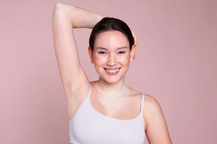 Simak Penyebab dan Cara Mencerahkan Ketiak Hitam dari Dermatolog! - Stylo