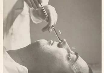 Berita Lobotomi Terbaru Hari Ini - National Geographic