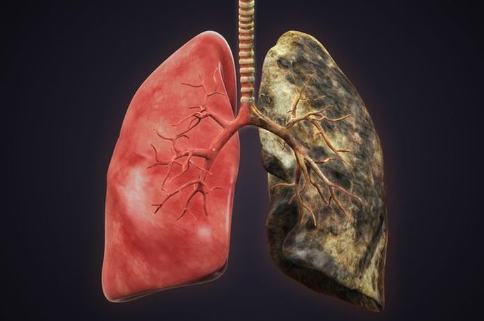 Nyesel Baru Tahu! Ternyata Begini 4 Cara Mudah Membersihkan Paru-paru ...