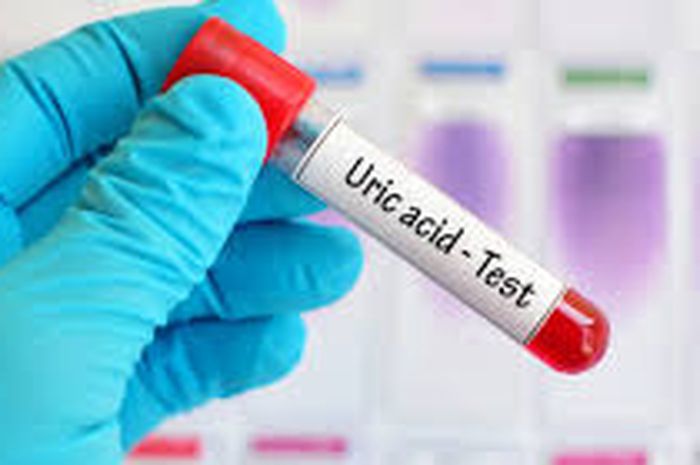 Ketahui Batas Normal Asam Urat Laki-laki, Perempuan, dan Anak - Semua ...