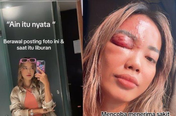Kena Ain? Wanita di Bali Ini Viral Ngaku Matanya Jadi Begini Usai Posting Foto Ini Saat Liburan ...