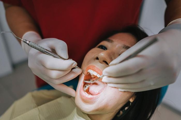 Ditanggung Penuh! Ini Cara Operasi Gigi Bungsu dengan BPJS Kesehatan - Nova