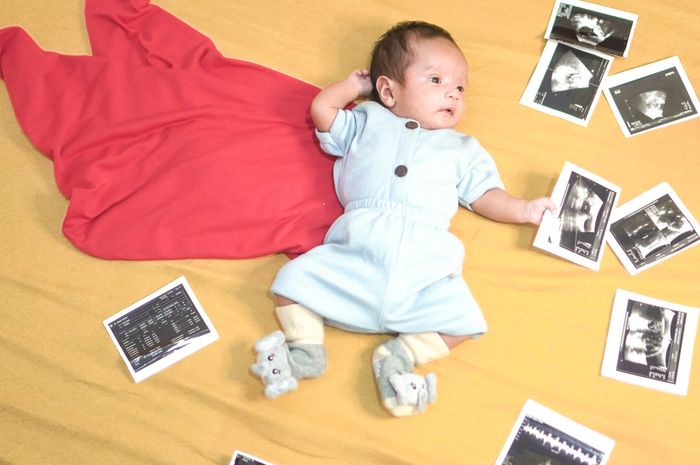 Cara Mengatasi Kaki Bengkok Pada Bayi yang Moms Harus Tahu, Catat! - Nakita