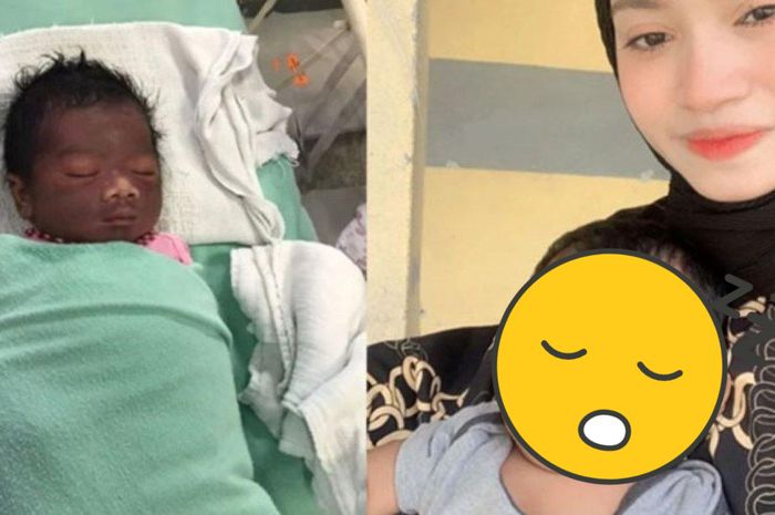 VIRAL Bayi Lahir dengan Kulit Hitam, Ibu Syok Tak Percaya Lihat Kondisi ...